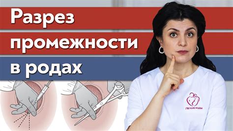 Что такое эпизиотомия в родах? / Какая вероятность повторной ...