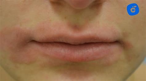 Cómo eliminar mucha saliva en la boca: causas, remedios y tratamientos ...