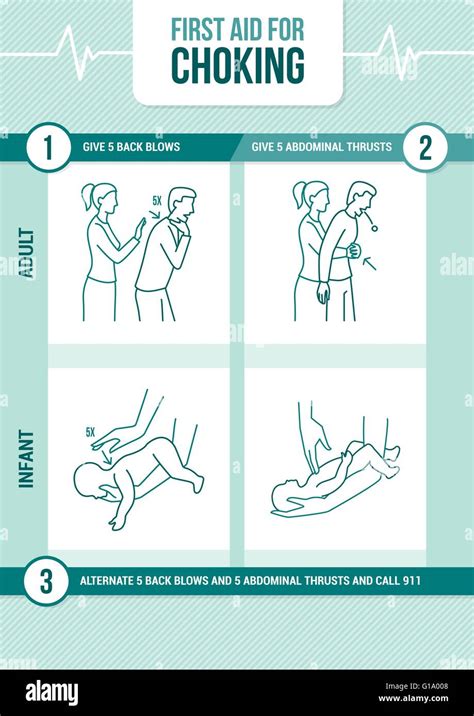 First aid procedure for choking and heimlich maneuver for adults and infants Stock Vector Image ...