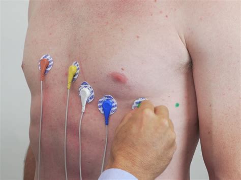 What Is A Normal 12 Lead Ecg at Paul Jamison blog