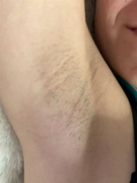 Do my petite 18yo armpits turn you on? : r/armpitfetish