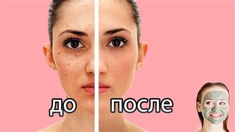 ГЛИНА ОТ ВЫСЫПАНИЙ, ПРЫЩЕЙ И ЧЕРНЫХ ТОЧЕК! - YouTube