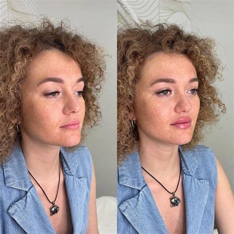 Estee Clinic | Клиника эстетической медицины