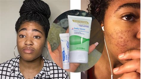 Differin Daily Deep Cleanser 4oz - Ivy's Store