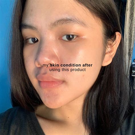 aya on Twitter: "semua orang harus tau kalo produk ini bikin redness ...