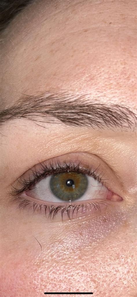 how do you call black eyes? : r/DnD
