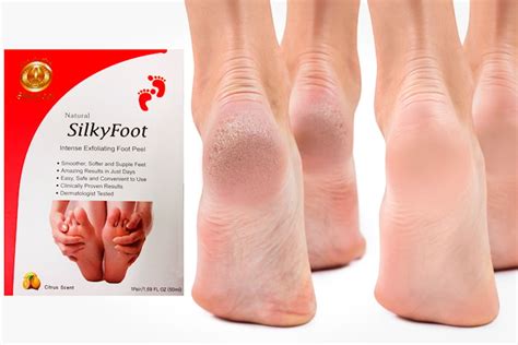 Silky Foot – Intense Exfoliating Foot Peel | Let's deal