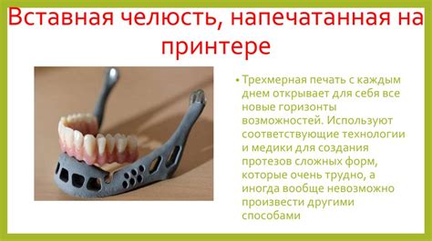 Искусственные объекты и их внедрение - презентация онлайн