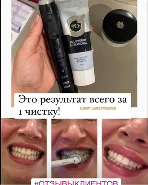 殺 БЕЛОСНЕЖНАЯ УЛЫБКА «Черника и древесный уголь», биоактивная зубная ...