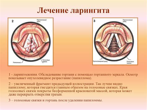 Отоларингология - презентация онлайн