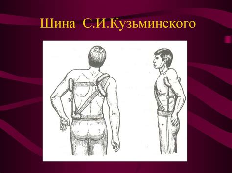 Повреждения надплечья и грудной клетки - презентация онлайн