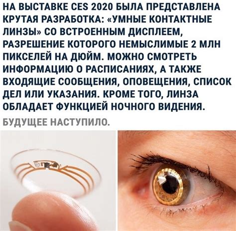 -lens |lenz| —линза