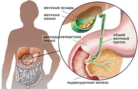 Диета при панкреатите, гастрите и холецистите