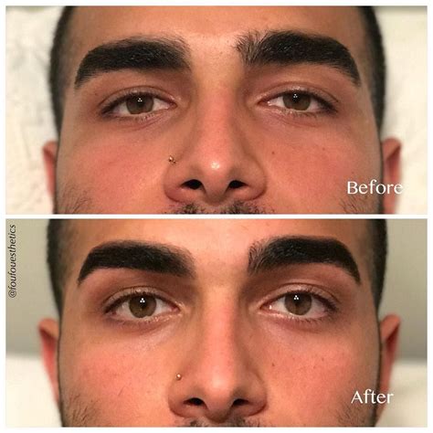 Guys Eyebrow Threading Before And After at Sherlyn Weyer blog