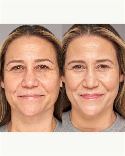Daily SPF 50 Primer – Credo