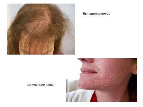 Цитостатики. НПВС - презентация онлайн