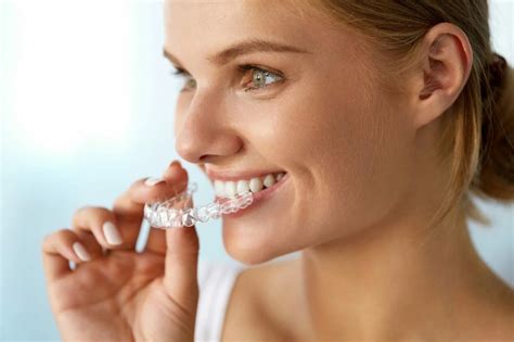 Элайнеры Invisalign - Cтоматология Май