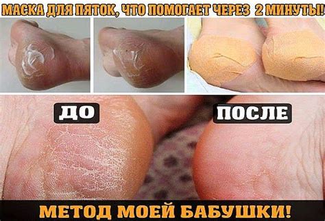 6 рецептов Маски для гладких пяток