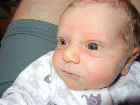Common skin conditions in babies - Mayo Clinic Press
