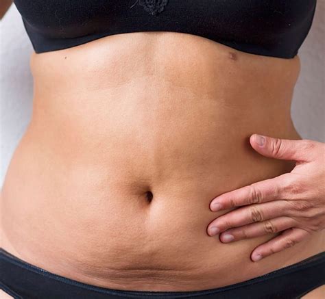 How to tell the difference between FAT and LOOSE skin - Health Guide Net