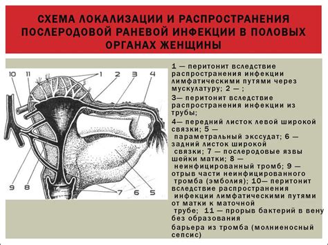 Послеродовые септические заболевания - презентация онлайн