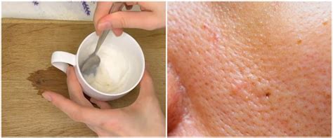 Without using a scrub, this is how to make pores smaller and remo