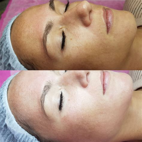 Что такое bb glow? Купить сыворотки bb glow.