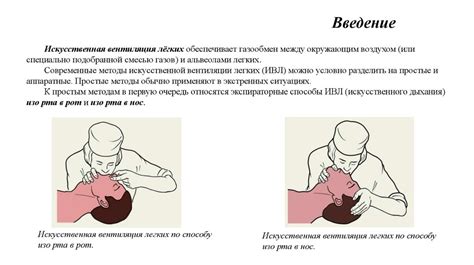 Искусственная вентиляция легких - online presentation