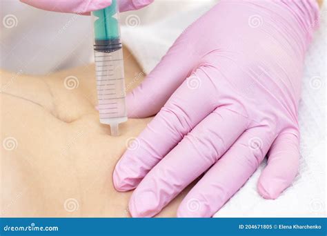 Lipolytic Injections are Placed in the Stomach Stock Image - Image of ...