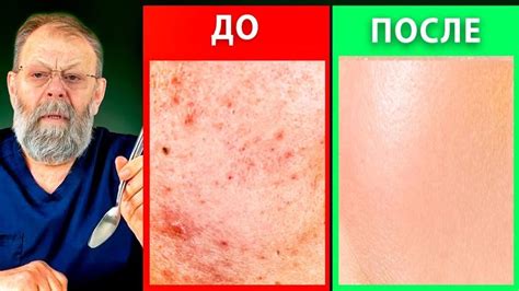 СОЛЬ И ВОДА — СЕКРЕТ ИДЕАЛЬНОЙ КОЖИ И ЗДОРОВОЙ ЖЕЛЧИ | Кожа, Подтяжка ...