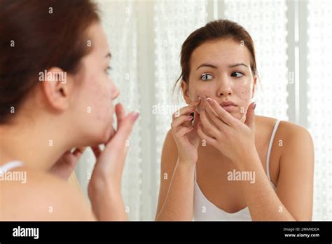 Teen girl with acne problem squeezing pimple near mirror in bathroom Stock Photo - Alamy