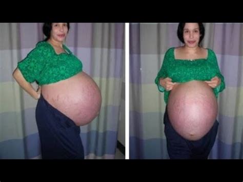 10 Самых Невероятных Случаев Материнства - YouTube