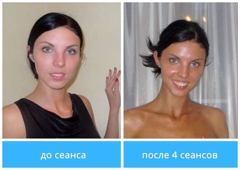 Как восстановить кожу после загара - основные рекомендации