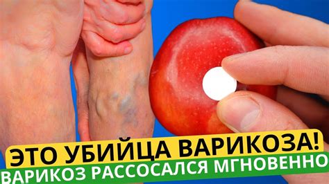 КИТАЙСКИЙ УБИЙЦА ВАРИКОЗА И СОСУДИСТЫХ ЗВЕЗДОЧЕК! За 15 минут в день ...