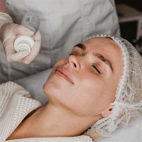 Everything You Need to Know About Azelaic Acid Peel