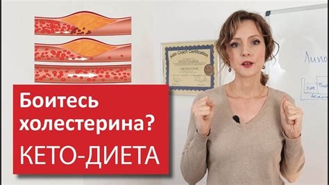 Какие анализы сдавать, если боитесь высокого холестерина - YouTube