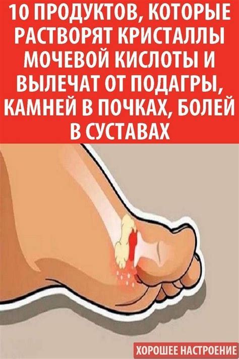 10 продуктов растворят кристаллы мочевой кислоты и избавят от подагры ...