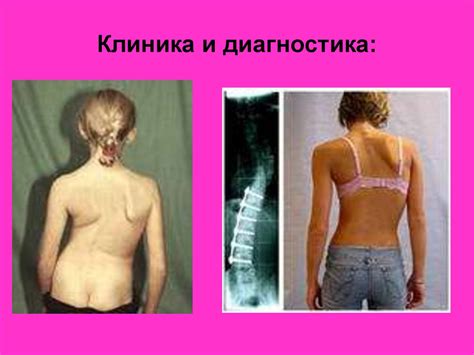 Детская ортопедия - презентация онлайн