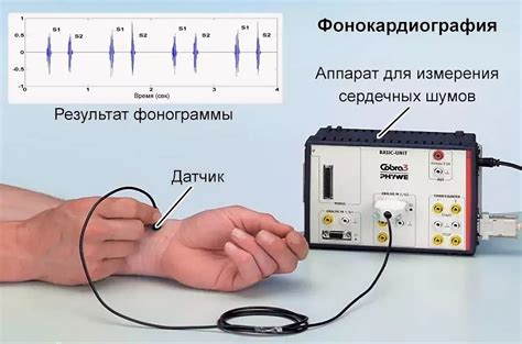 Фонокардиография: суть метода и показания для проведения, расшифровка
