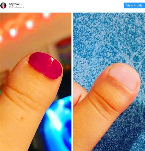 «Что с твоим пальцем?!»: 18 шуток, которые прекрасно поймут обладатели ...