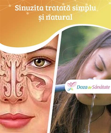 Sinuzita tratată simplu și natural În timp ce te tratezi de sinuzită ...