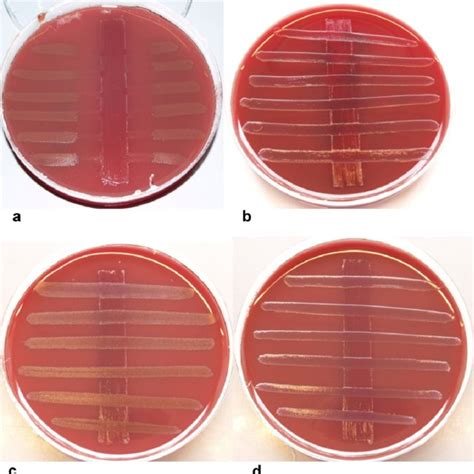 (PDF) Antimicrobial activity of Streptococcus salivarius K12 on ...