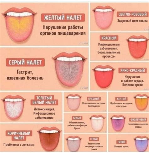 ЛЕЧЕБНИК ИЗ ПРОШЛОГО on Instagram: “Ваш язык расскажет о проблемах со ...