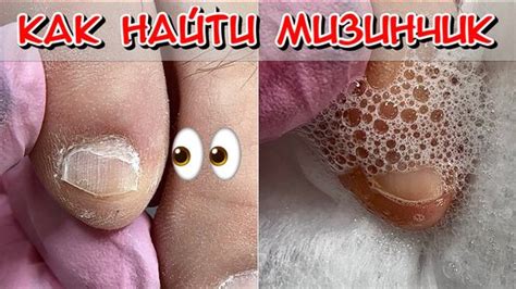 Как найти мизинчик? на мизинце странный ноготь что делать / где мизинец ...