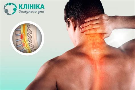 «Почему возникает боль в спине между лопатками: причины и способы лечения»