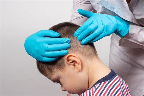Профилактика педикулёза у детей — что такое педикулез, причины и ...