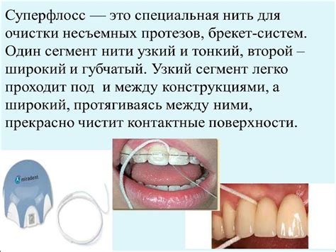 Средства гигиены полости рта - презентация онлайн