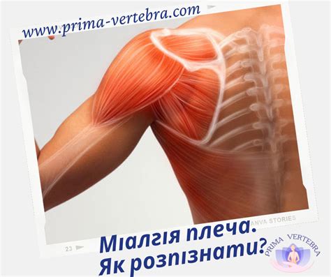 Миалгия плеча. Как распознать? - Prima-Vertebra