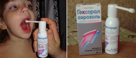 Спрей для горла при ангине у взрослых с антибиотиком, спрей при ...