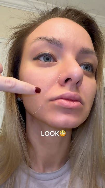 КОЛЛАГЕНОВАЯ НИТЬ🤩#уходзалицом #уходзакожей #сша #usa #переездвсша # ...